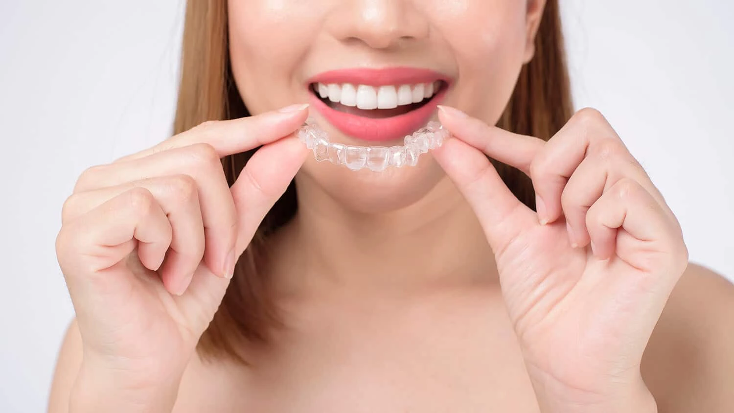 Invisalign Orthodontic - Camtu Dental